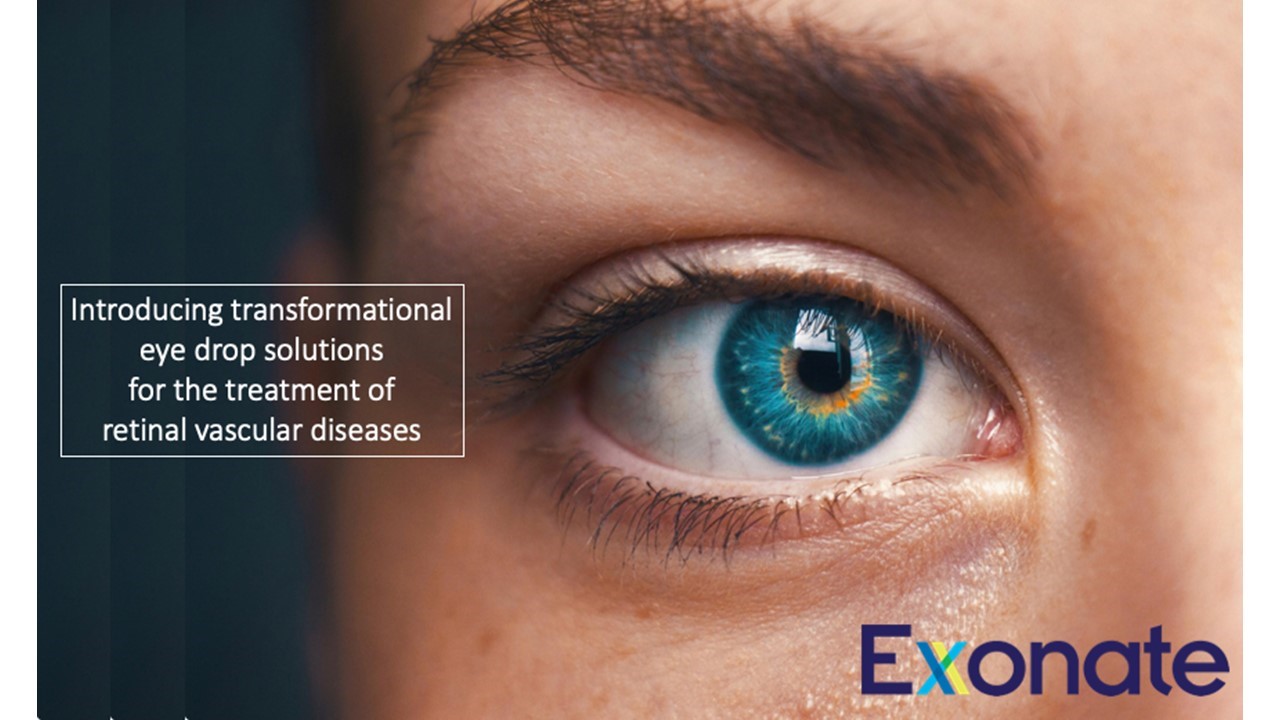 Exonate Announces Collaboration with Janssen to develop a new eye drop ...